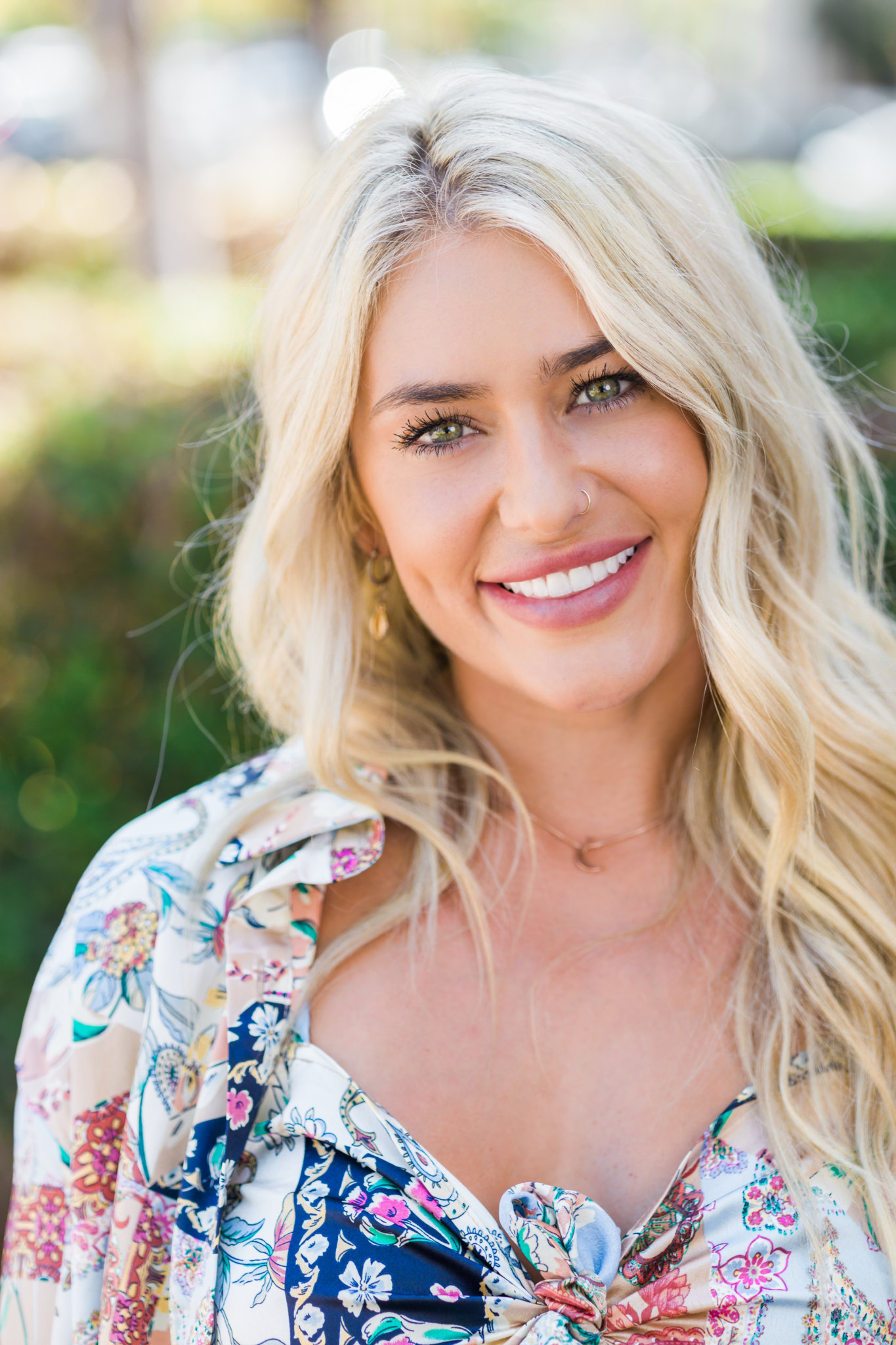 Understanding Temporary Veneers: 5 Key Points You Should Know