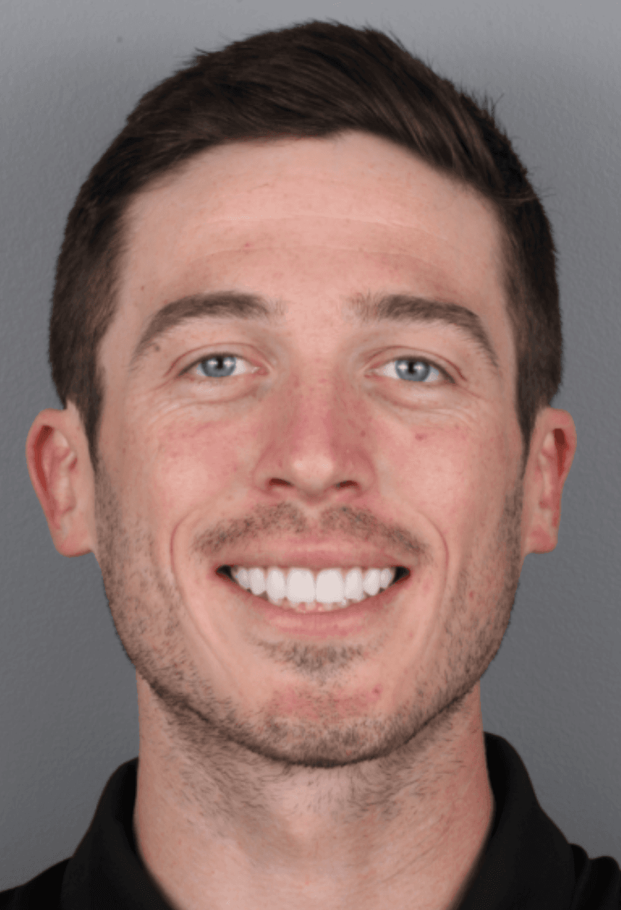 Understanding Temporary Veneers: 5 Key Points You Should Know