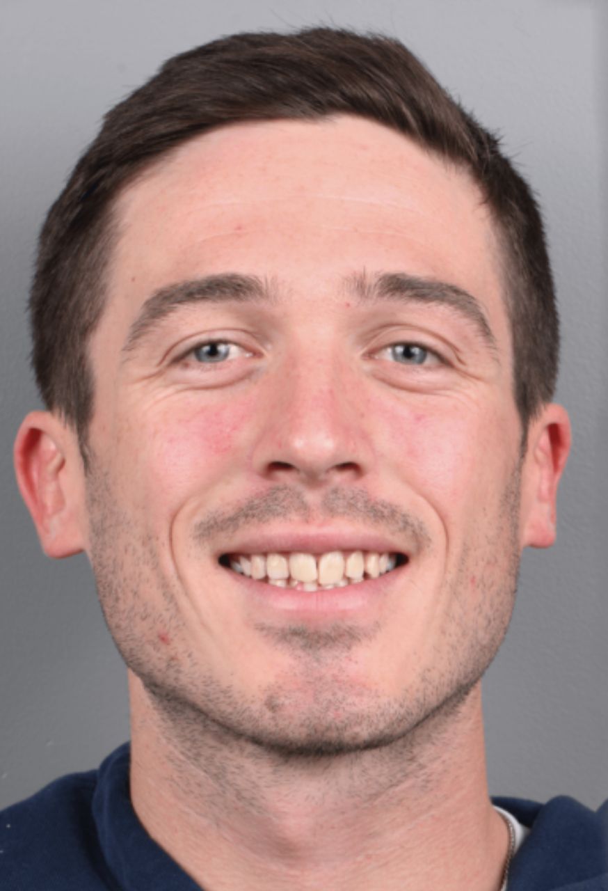 Understanding Temporary Veneers: 5 Key Points You Should Know